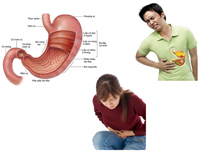 Bệnh đau dạ dày nên và không nên ăn gì? Cách chữa bệnh đau dạ dày